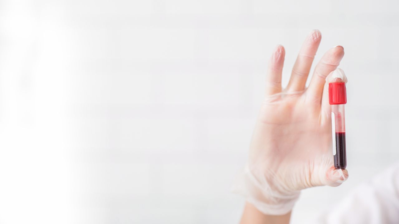 Alzheimer Blood Test: What It Detects and How It Works